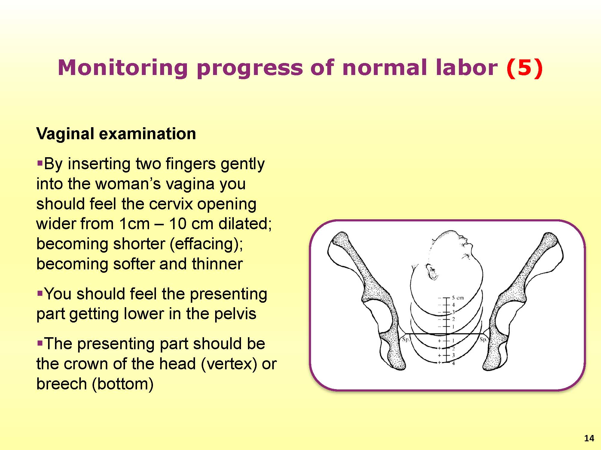 Vaginal Examination In Labour